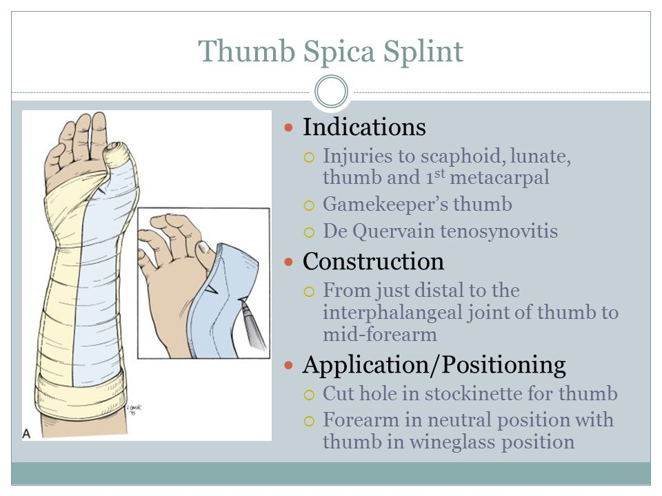 Splinting Procedures Er Dispo