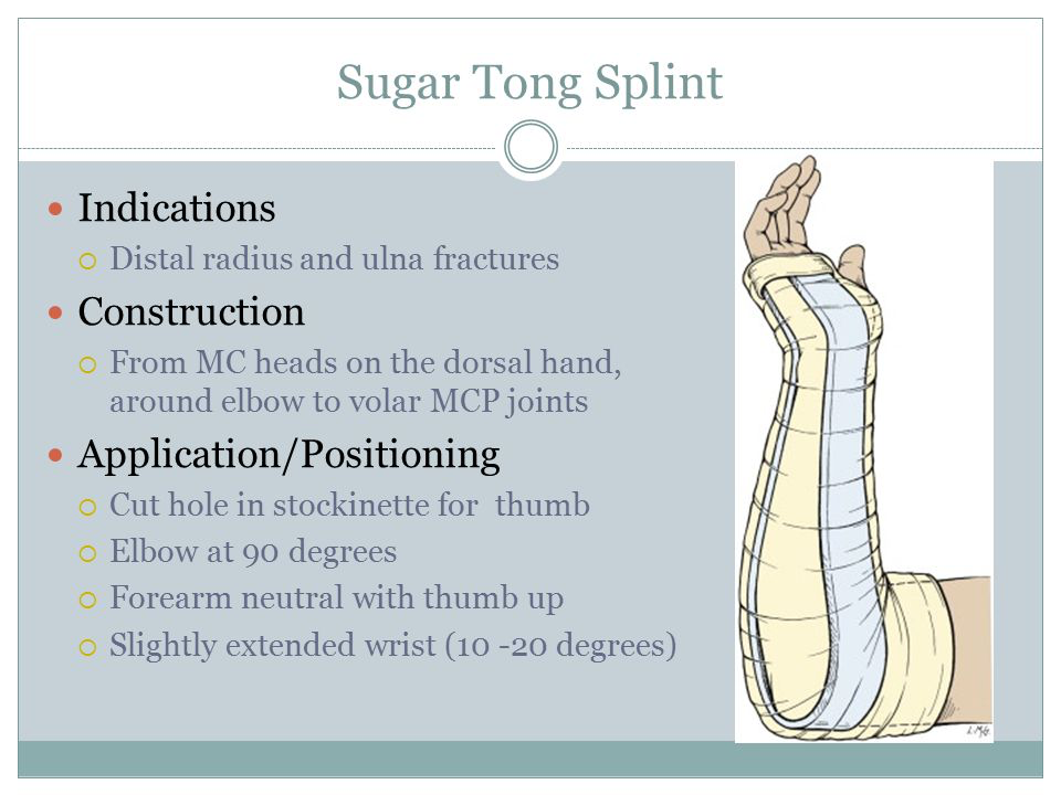 Splinting Procedures Er Dispo